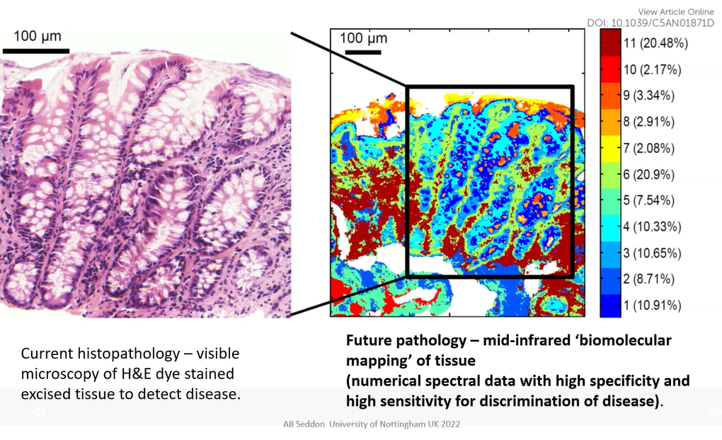 Mid-Infrared fiber-optics leading the future for early cancer detection ...